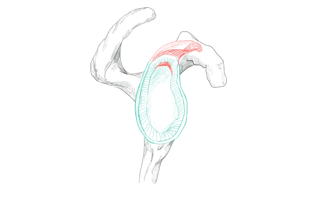 Lesão de SLAP – Ortopedistas
